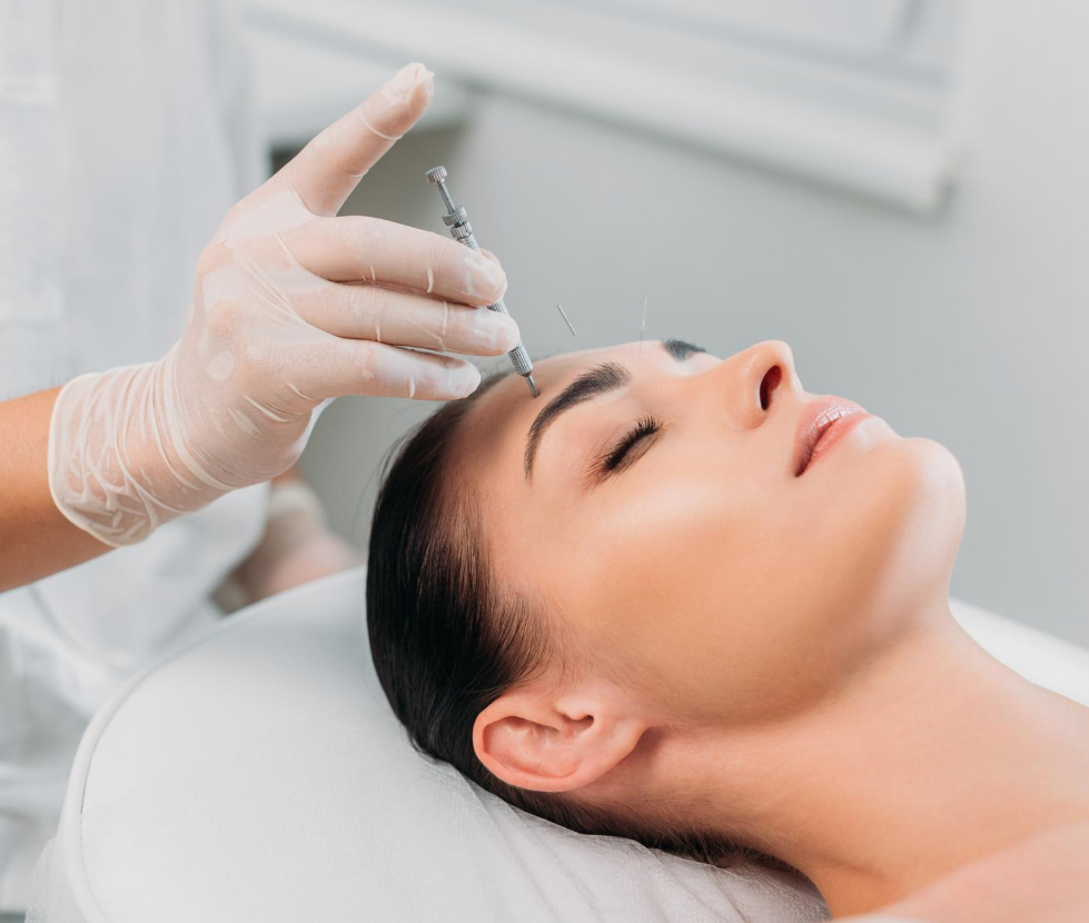 Acupuncture - AVISINA WELLNESS CENTER